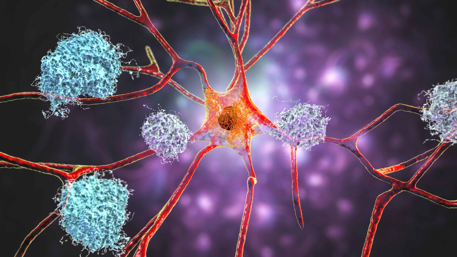 Pioneering Alzheimer’s Research at Rutgers: Dr. William Hu’s ...